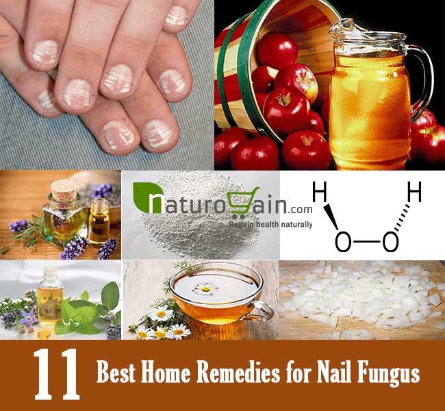 11 Effective And Best Home Remedies For Nail Fungus