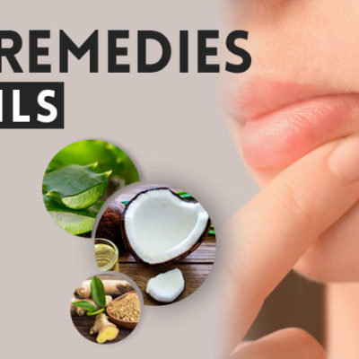 9 Home Remedies For Skin Rashes And Itching