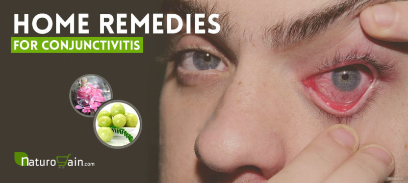 9 Best Home Remedies for Conjunctivitis to Prevent Pink Eyes [Naturally]