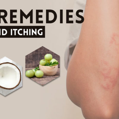 10 Natural Home Remedies For Skin Abscess And Boils