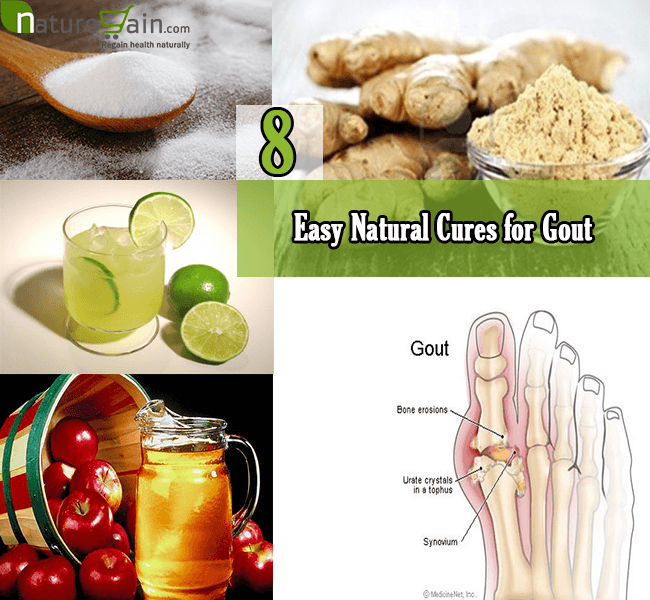 8 Powerful And Easily Available Natural Cures For Gout