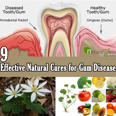 10 Natural Home Remedies For Skin Abscess And Boils