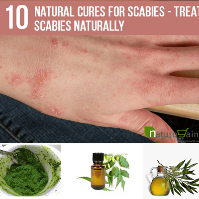 7 Best Home Remedies for Scabies to Prevent Skin Rashes