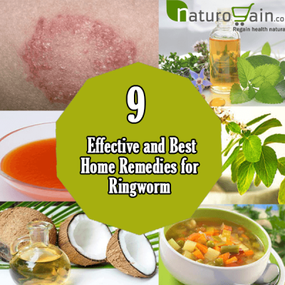 9 Home Remedies For Skin Rashes And Itching