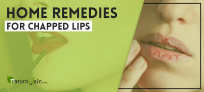 11 Best Home Remedies for Chapped Lips to Get Rid of Cracked Lips