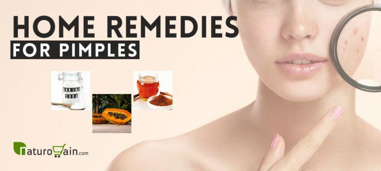 6 Home Remedies for Pimples - Get Rid of Acne Naturally [and Quickly]