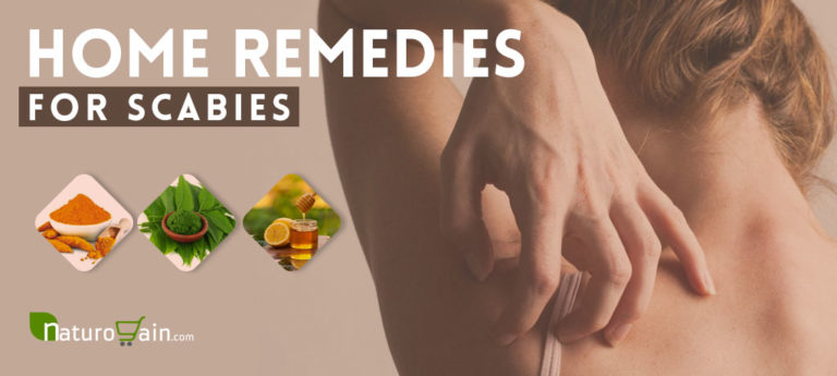 6 Home Remedies for Scabies - Herbal Treatments that Work