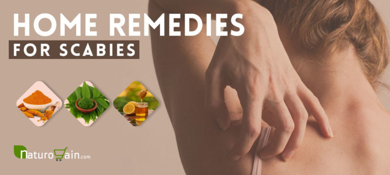 6 Home Remedies for Scabies - Herbal Treatments that Work