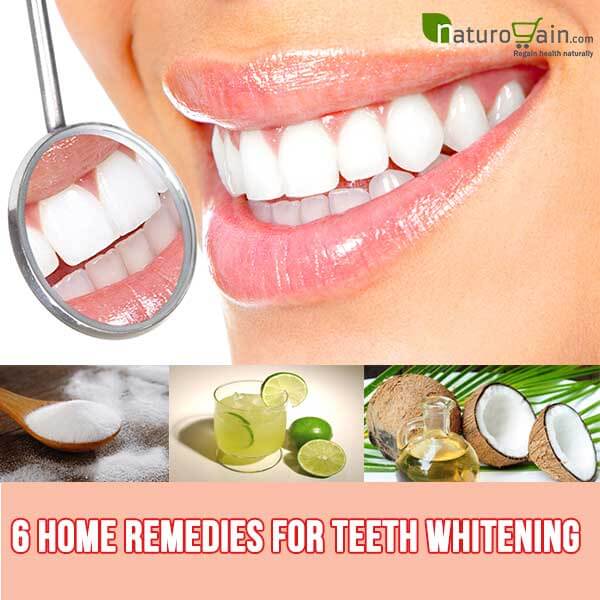6 Home Remedies For Teeth Whitening Get Rid Of Yellow Teeth