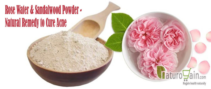 9 Best Home Remedies for Acne to Prevent Marks and Scars