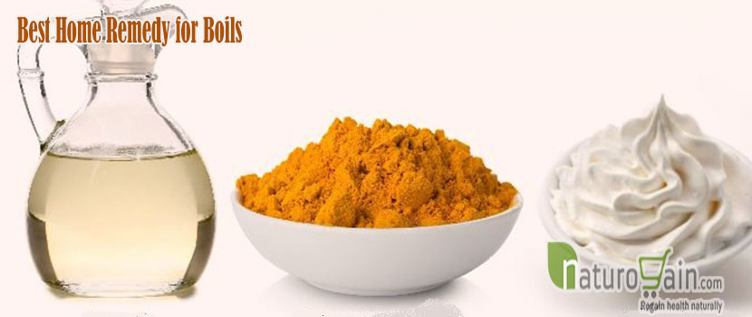 8 Effective and Best Home Remedies for Boils