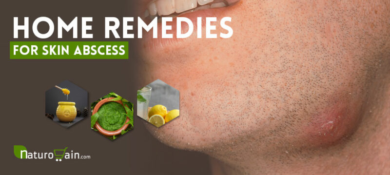 8 Safe and Best Home Remedies for Skin Abscess