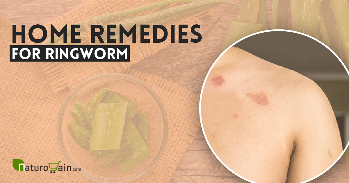 8 DIY Home Remedies for Ringworm Treatment that Work