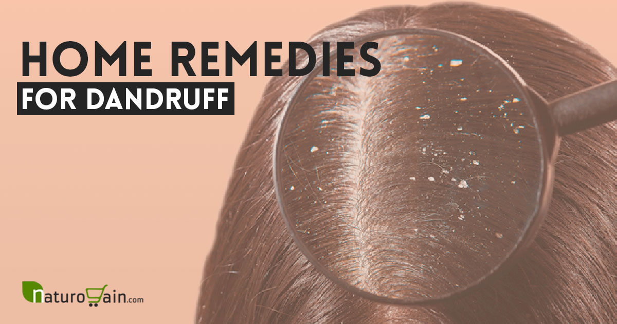 9 Home Remedies for Dandruff to Eliminate Stubborn White Flakes